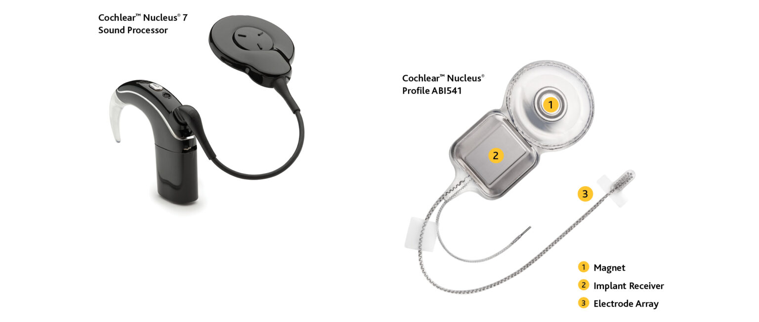 Auditory Brainstem Implants - Otolaryngology–Head & Neck Surgery