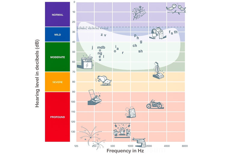 WashU leads effort to standardize the Common Sounds Audiogram ...